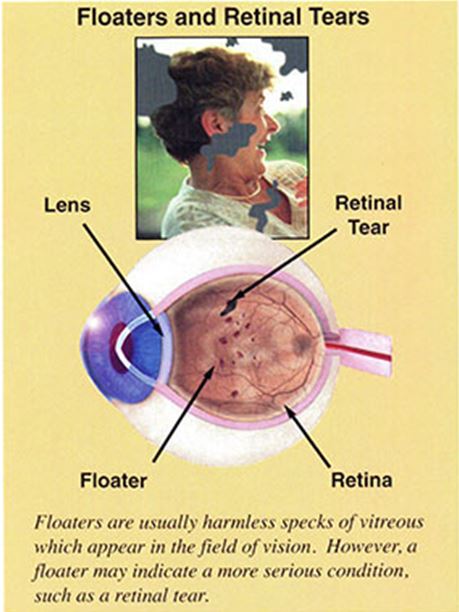 Retina Specialists of Mississippi - Board Certified Eye Doctors