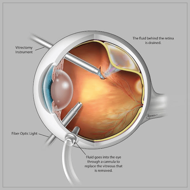 Retina Specialists of Mississippi - Board Certified Eye Doctors