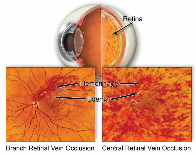 Retina Specialists of Mississippi - Board Certified Eye Doctors